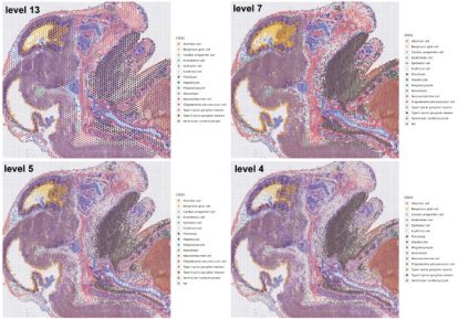 空间组学与单细胞联合分析方法之RCTD | | 百迈客生物
